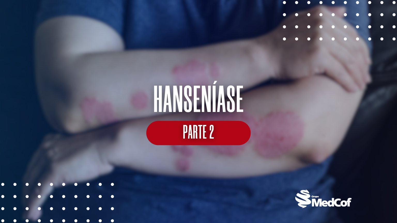 Formas clínicas da hanseníase - Blog de Medcof: conteúdos, editais ...