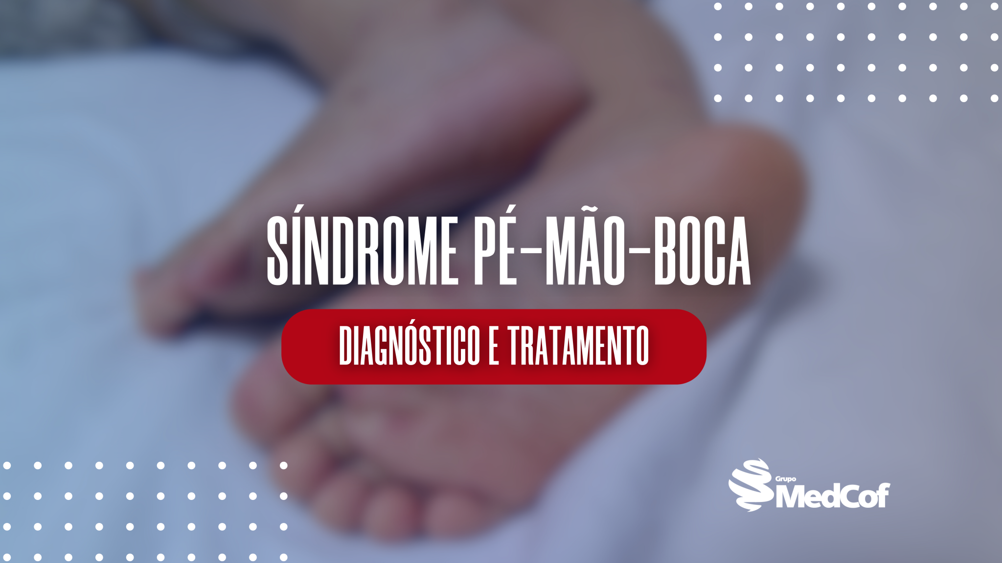 Doença mão-pé-boca: saiba os sintomas, causas e tratamentos