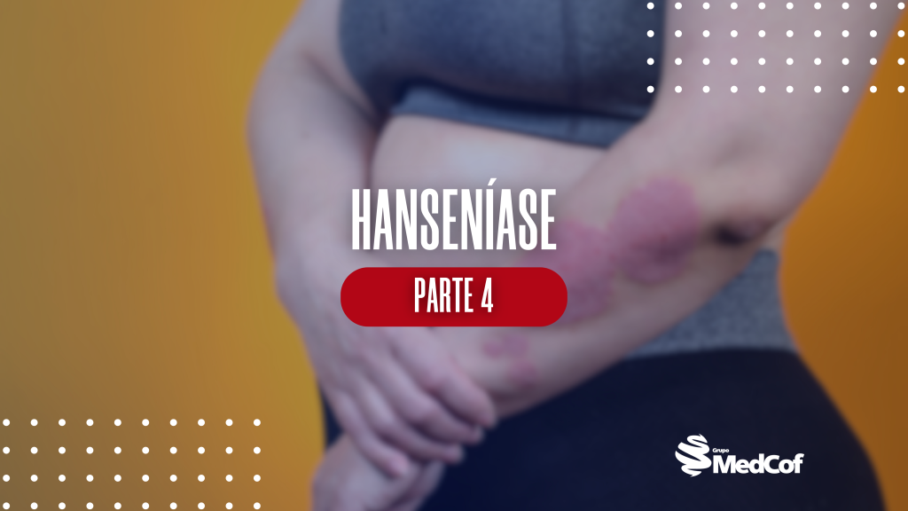 Hanseníase: diagnóstico e tratamento - Blog de Medcof: conteúdos ...