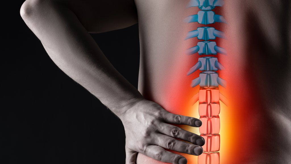 Lombalgia: Você conhece os sinais de alerta? - Blog de Medcof ...
