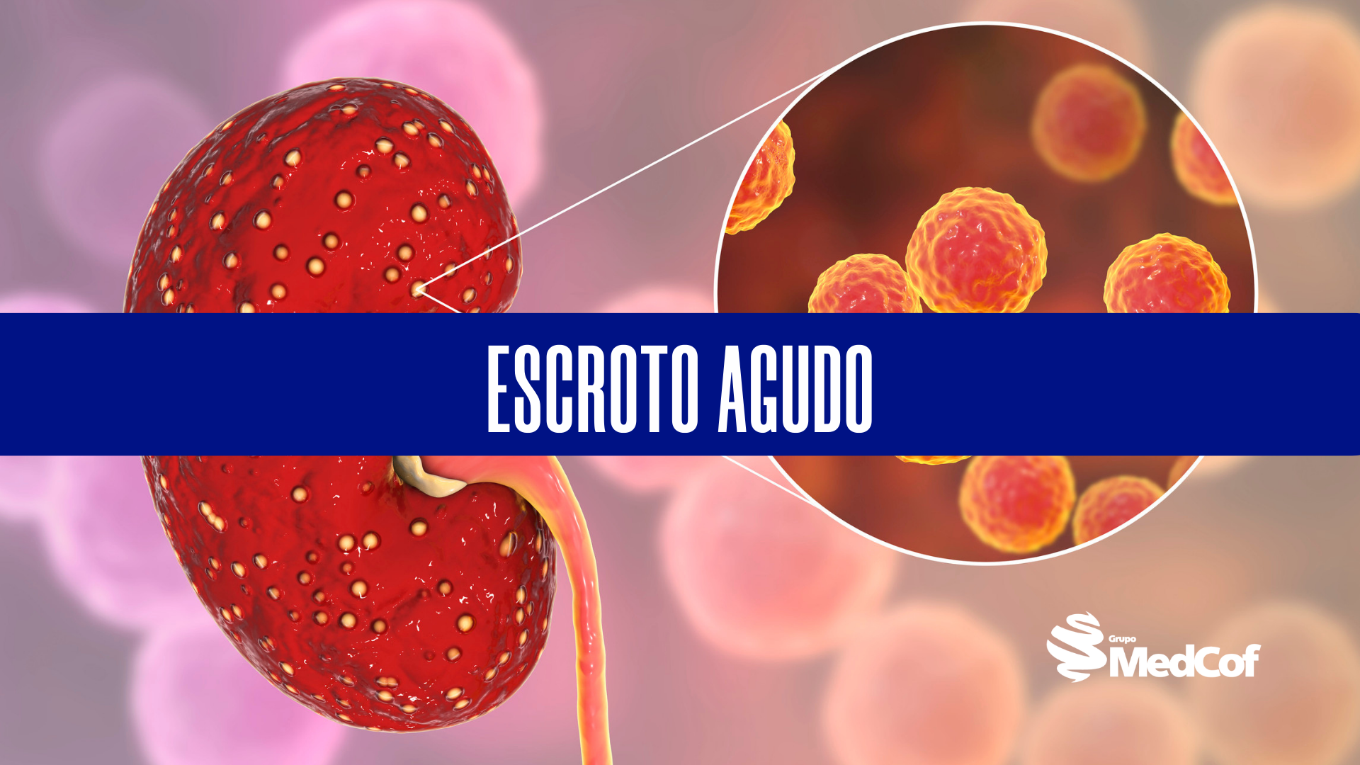 Escroto agudo: como manejar? - Blog de Medcof: conteúdos, editais ...