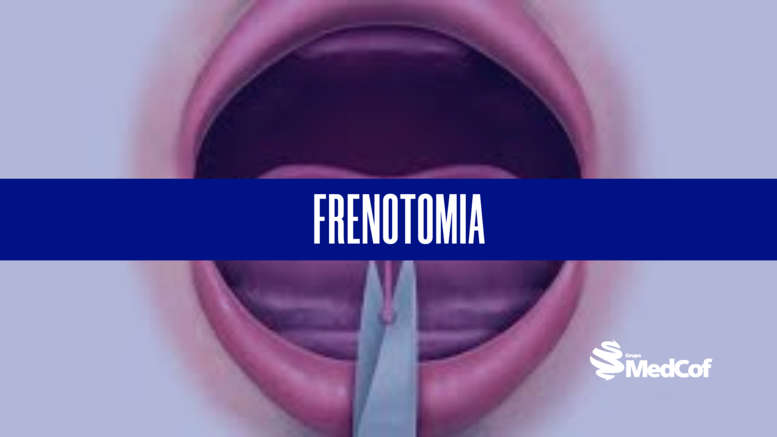 Frenotomia: o que é, quando e como realizar - Blog de Medcof: conteúdos ...