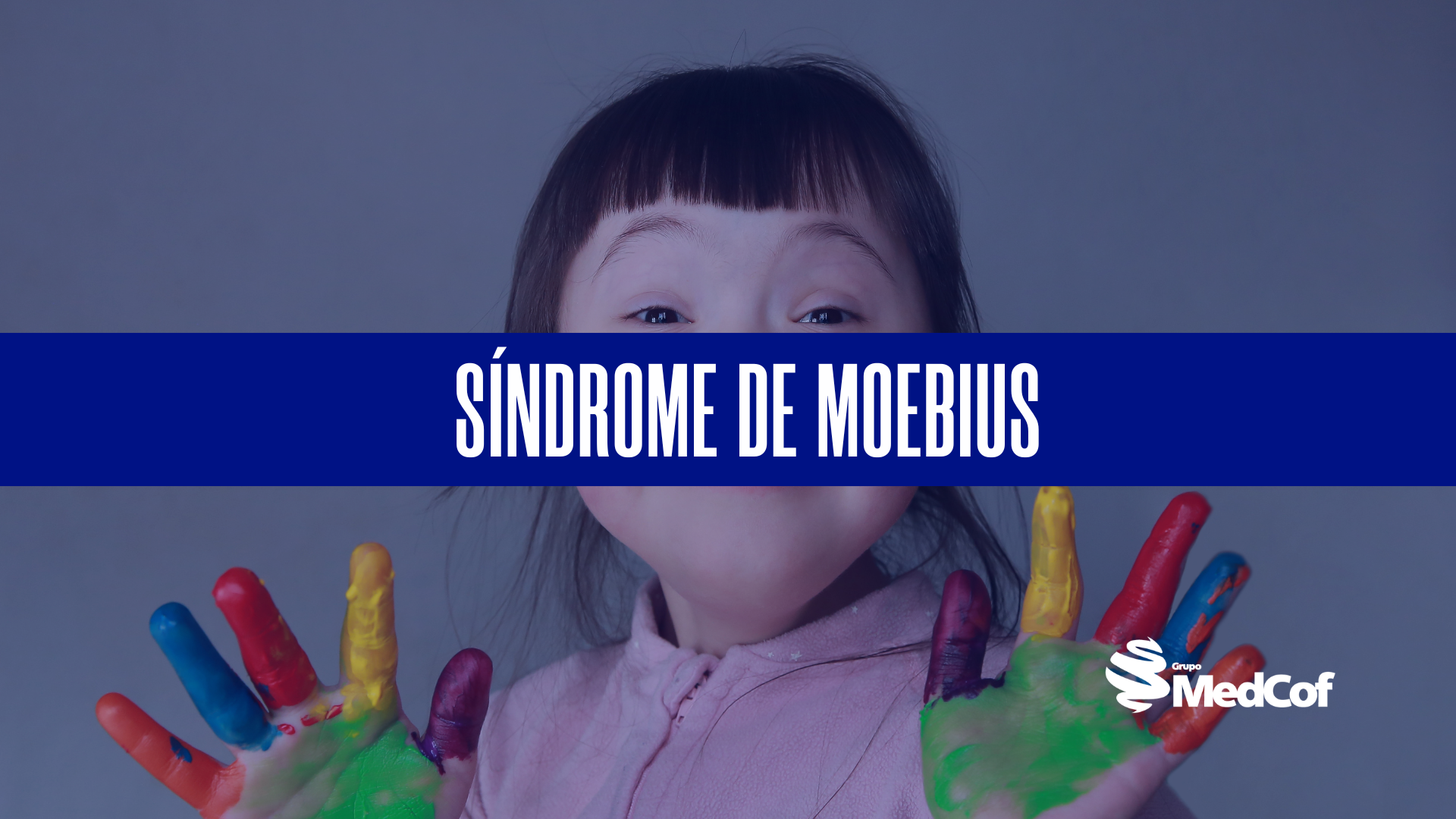 Síndrome de Moebius: tudo o que você precisa saber. - Blog de Medcof ...