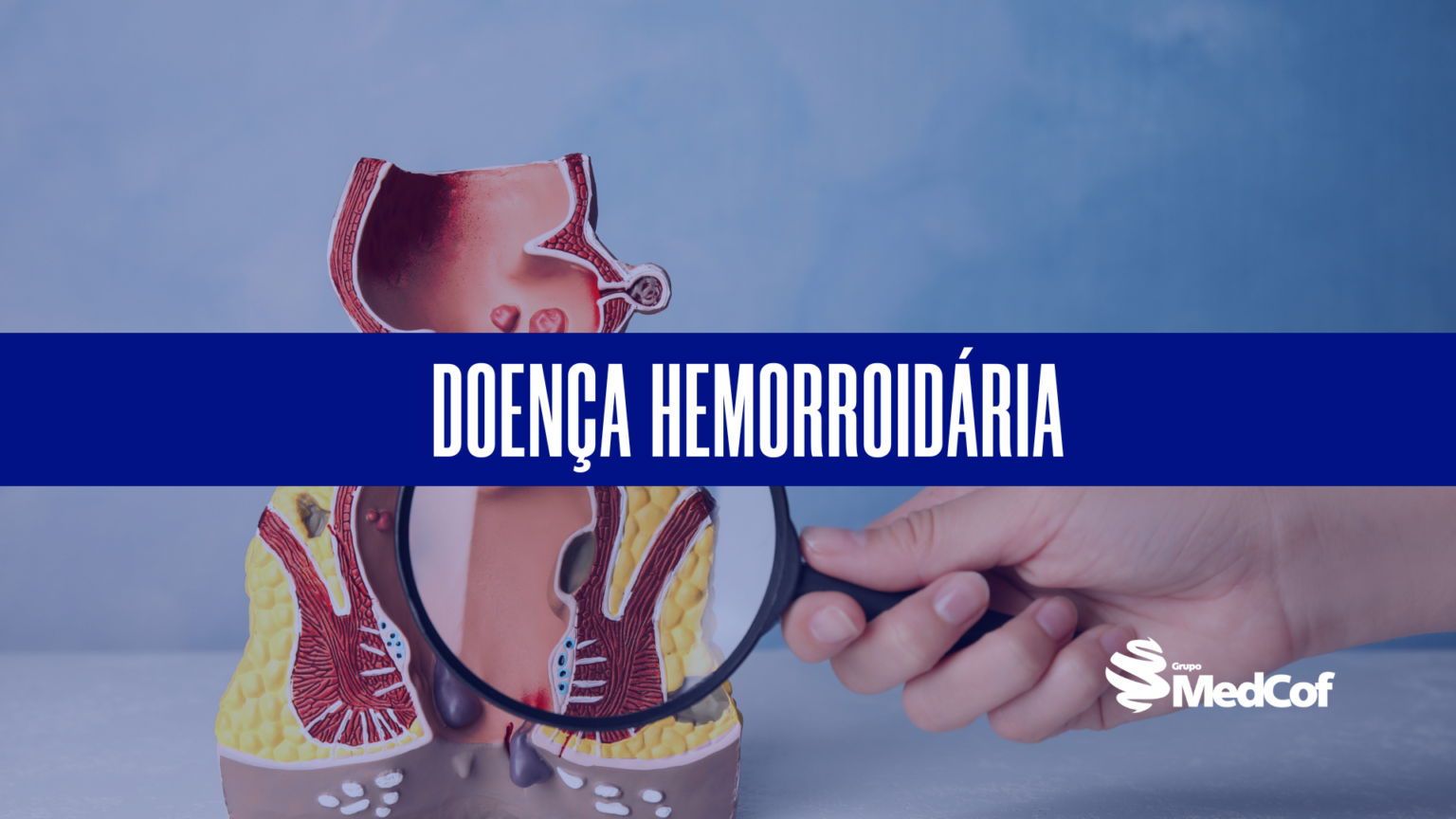 Doença Hemorroidária: Causas, Sintomas, Diagnóstico e Tratamento - Blog ...