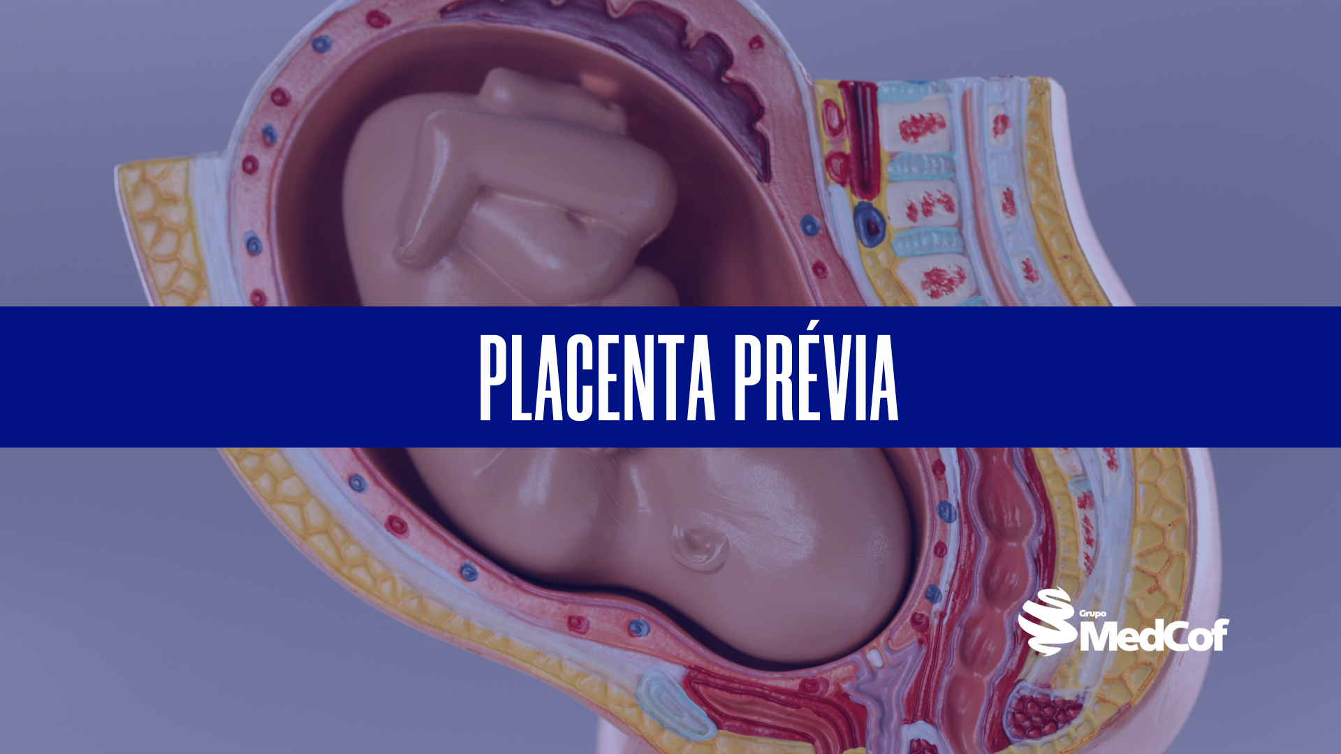 Placenta Prévia: Entenda o Diagnóstico Diferencial e a Conduta Adequada ...