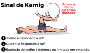 Sinais meníngeos: o que você precisa lembrar. - Blog de Medcof ...