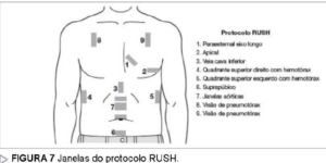 Saiba tudo sobre o protocolo RUSH para avaliação do choque! - Blog ...