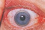 Diagnóstico de Dislipidemia: Classificação e Tratamento do paciente ...